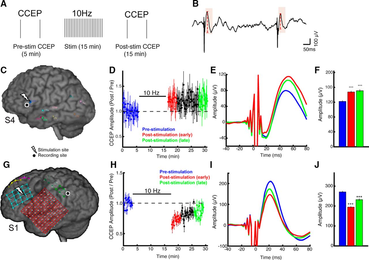 JNeurosci: New Method for the Development of Personalized Brain Stimulation Therapies Found ...